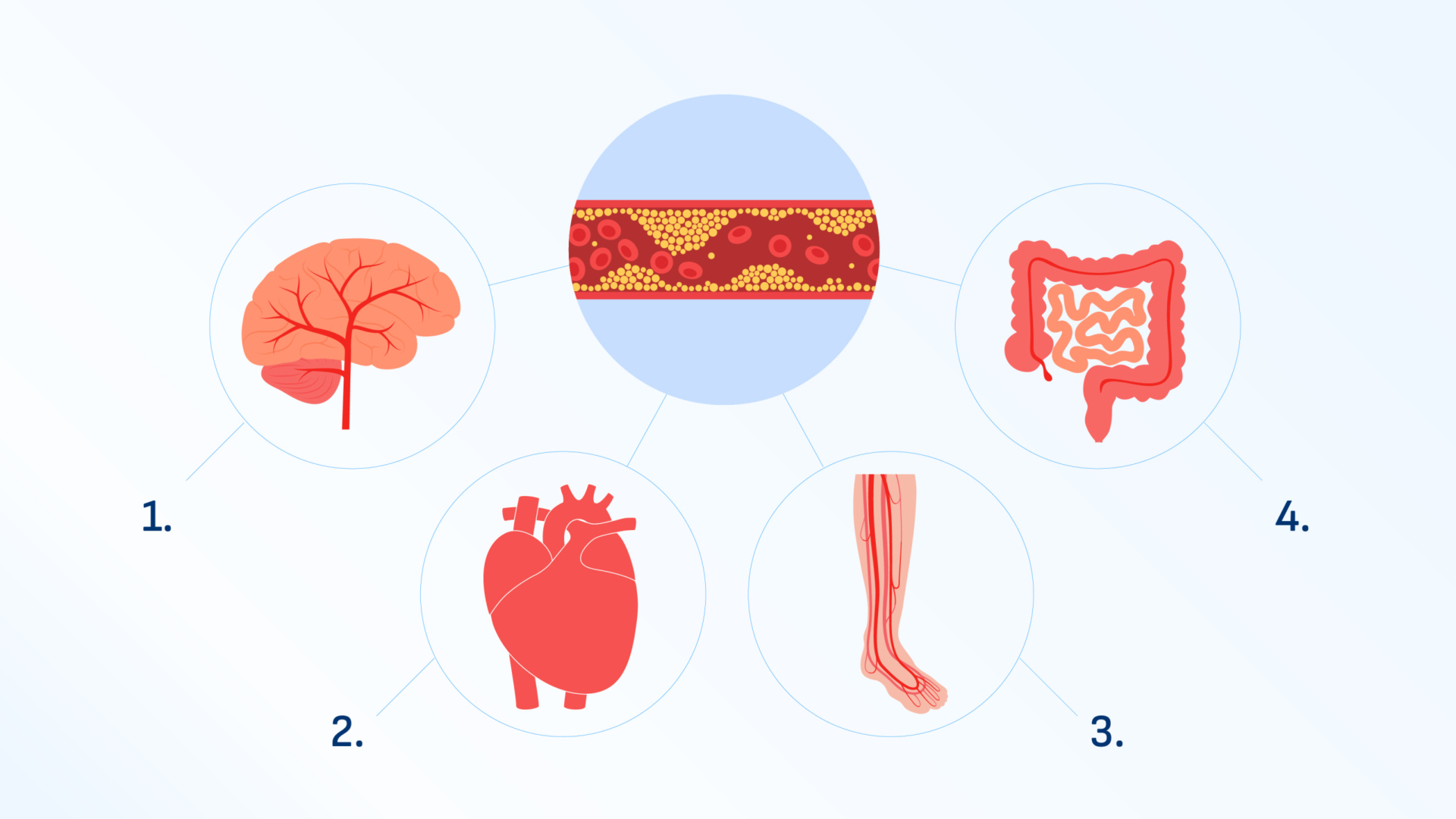 Durchblutungsstörungen der Beine - Beschreibung, Behandlung