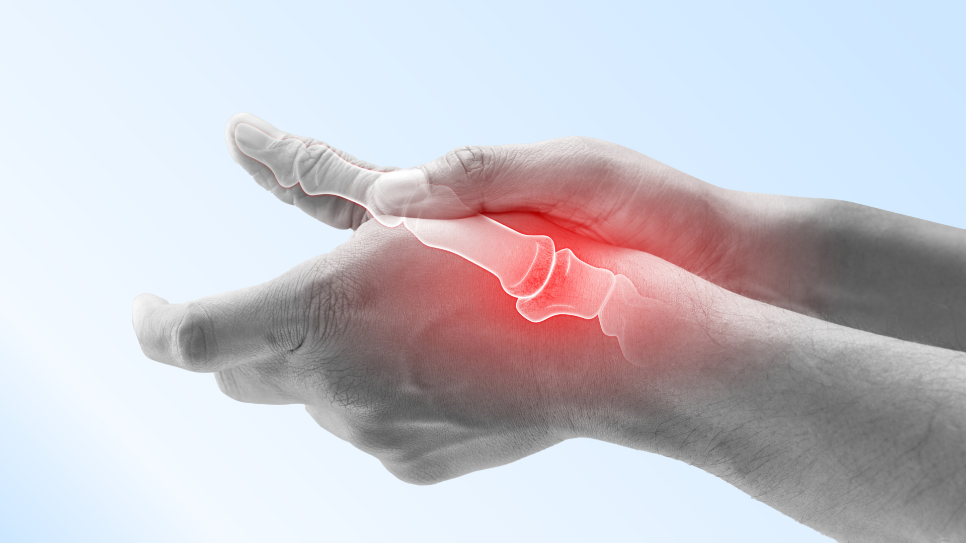 Entzündung des Handgelenks und der Hand - Behandlung